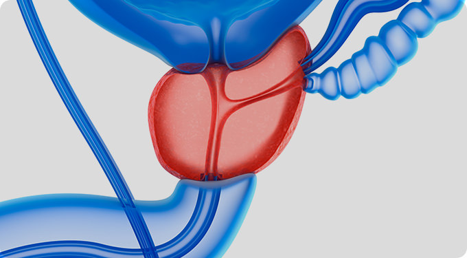 O Que é Prostatite E Porque Incomoda Tanto Os Homens Cartão De Visita News