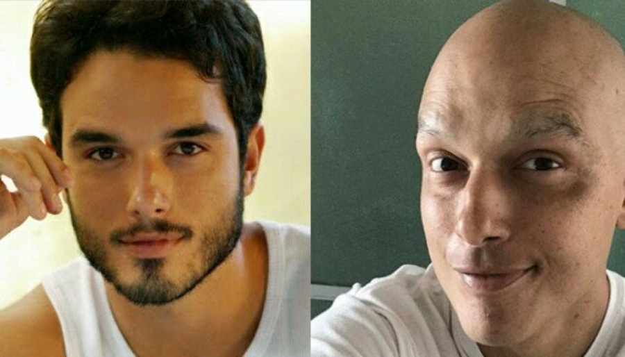 Morre, aos 37 anos, o ator Léo Rosa; o artista lutava contra o câncer ...